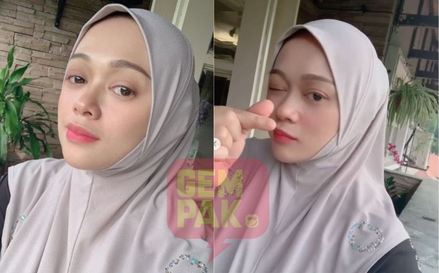 "Saya Tak Down, Tak Murung, Tak Sedih" - Lumpuh Sebelah Muka, Ini ...