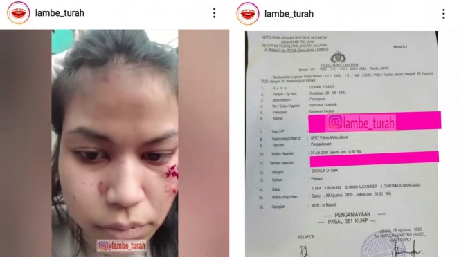 Dianni Ivanda Mengaku Dianiaya Putra Cintami Atmanegara | Gempak