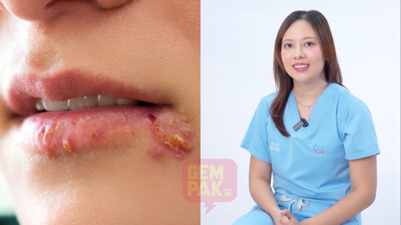 “Tak Boleh Sembuh Sepenuhnya Tapi Bukan Punca Mandul!” - Dr Aen Kongsi ...