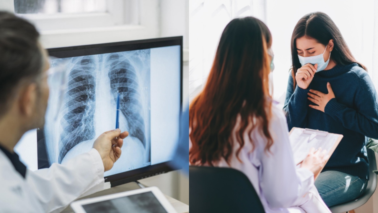 Tuberculosis Is Not Just a Cough: Here’s Everything You Need to Know ...