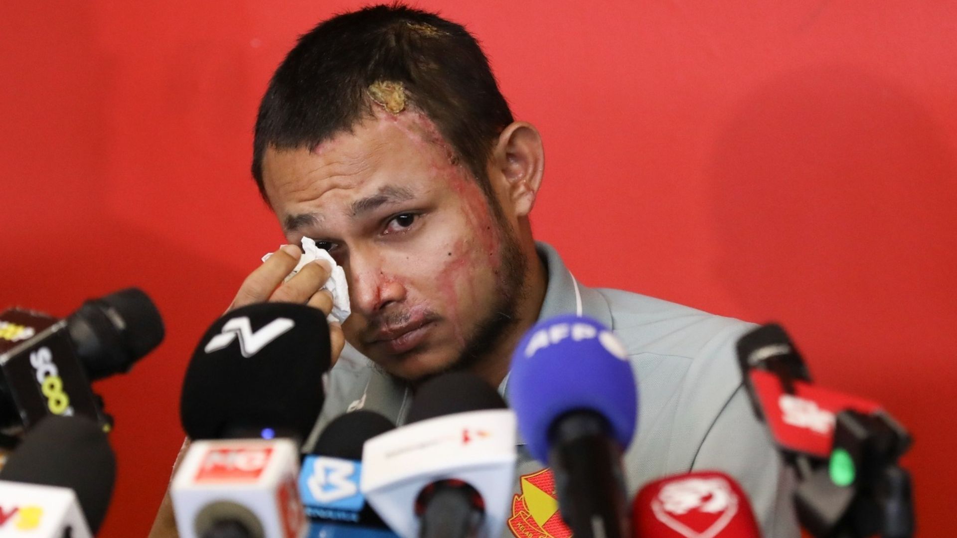 Hatinya luluh lantak, Faisal Halim tidak boleh terima disimbah asid ...